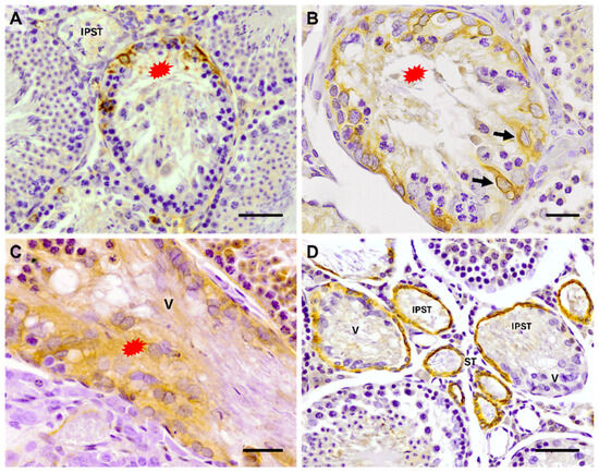 The Terminal Segment of the Seminiferous Tubule: The Current Discovery ...