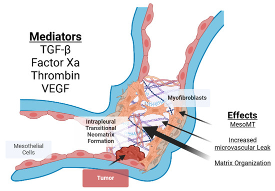 Research Priorities for Malignant Pleural Organization with Loculation ...