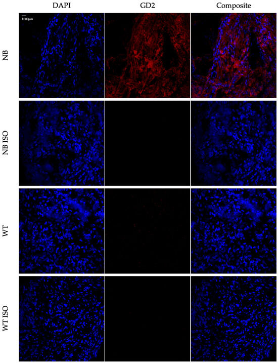 A Backwards Approach to GD2 Immunofluorescence in Human Neuroblastoma ...