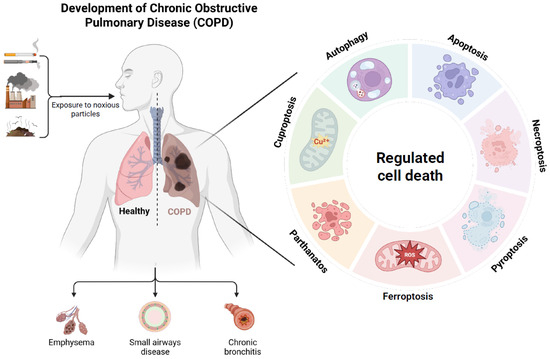 Copd Pathophysiology Scholarly Articles