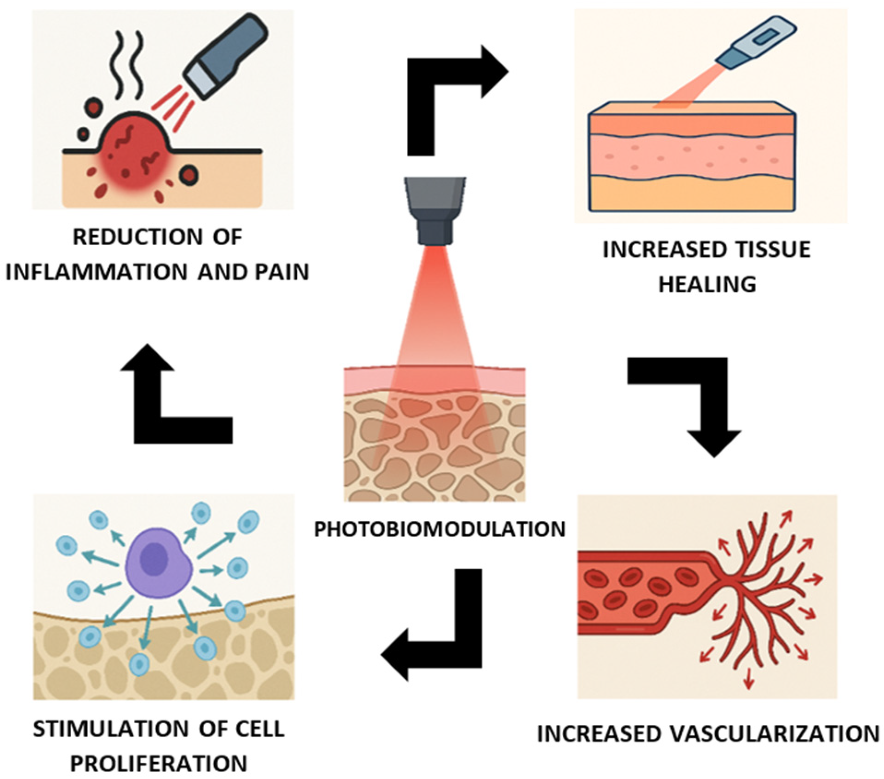 Effects of Photobiomodulation in Association with Biomaterials on the ...