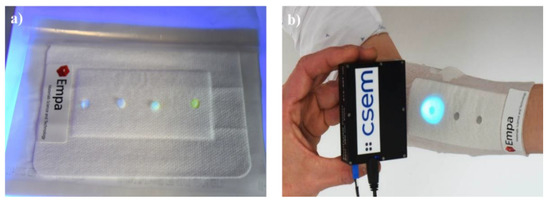 Emerging Strategies Based on Sensors for Chronic Wound Monitoring and ...