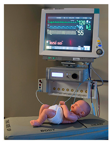 Sensory Stimulation in the NICU Environment: Devices, Systems, and ...