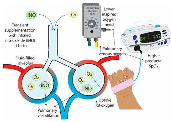 Inhaled Nitric Oxide at Birth Reduces Pulmonary Vascular Resistance and ...