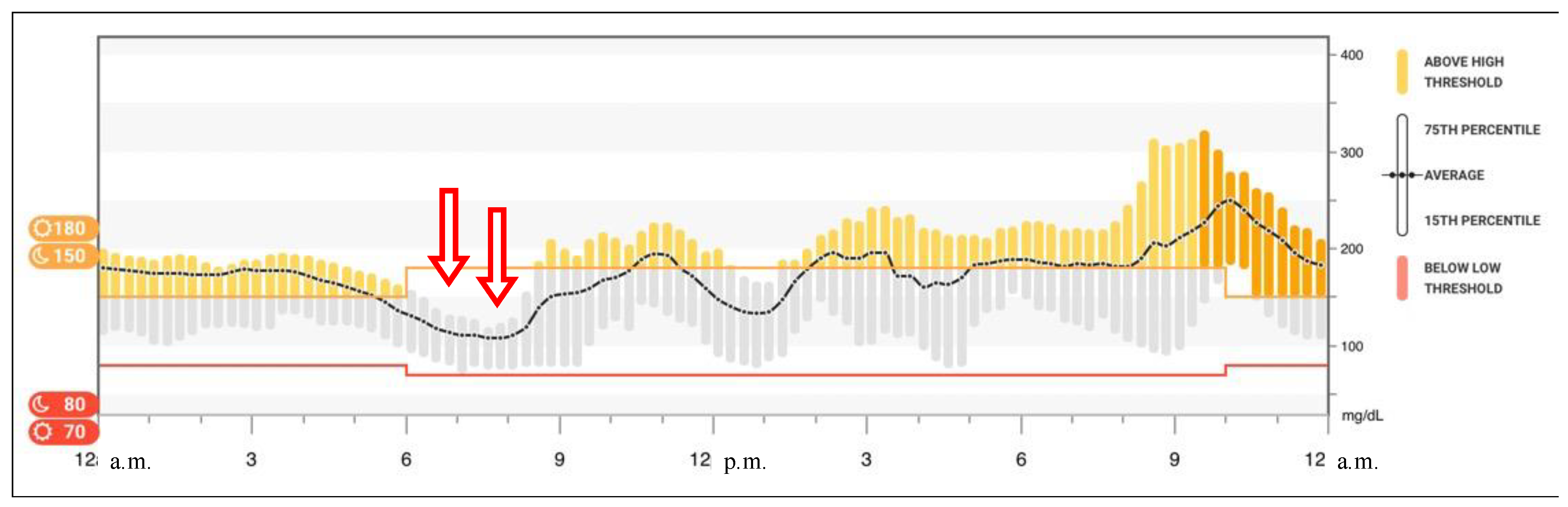 Type 1 Diabetes and Addison’s Disease: When the Diagnosis Is Suggested ...