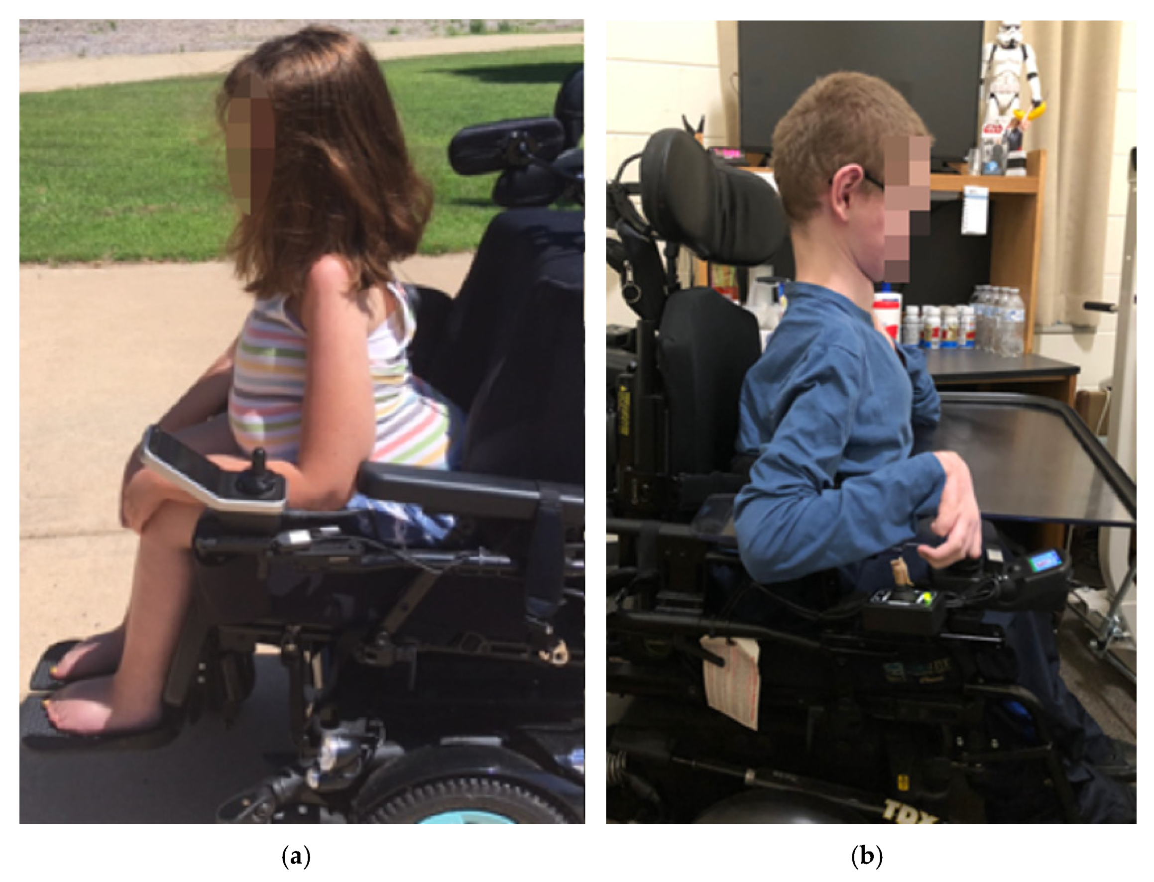 Sagittal Plane Deformities in Children with SMA2 following Posterior ...