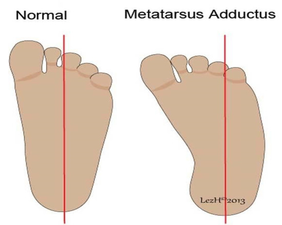 Evaluation and Risk Assessment of Congenital Anomalies in Neonates
