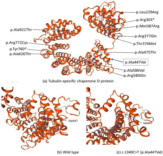 Novel Compound Heterozygous Variants in TBCD Gene Associated with ...