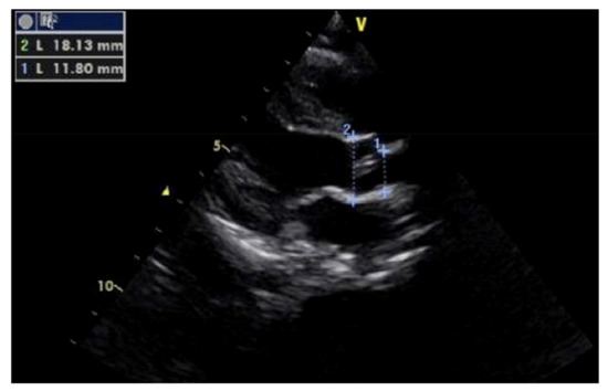 A Case of William’s Syndrome in a Ugandan Child: A Feasible Diagnosis ...