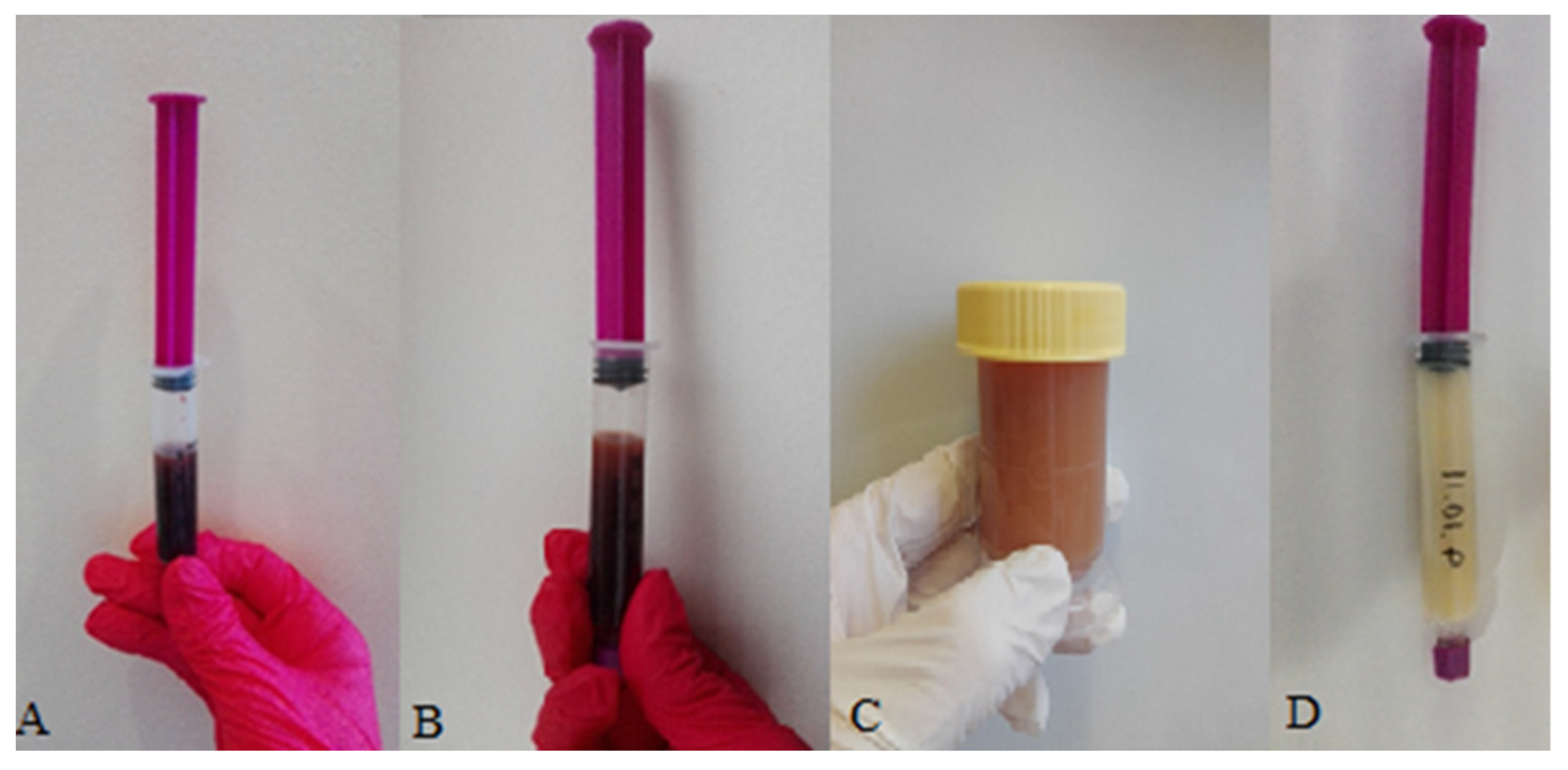 Blood-Stained Colostrum: A Rare Phenomenon at an Early Lactation Stage