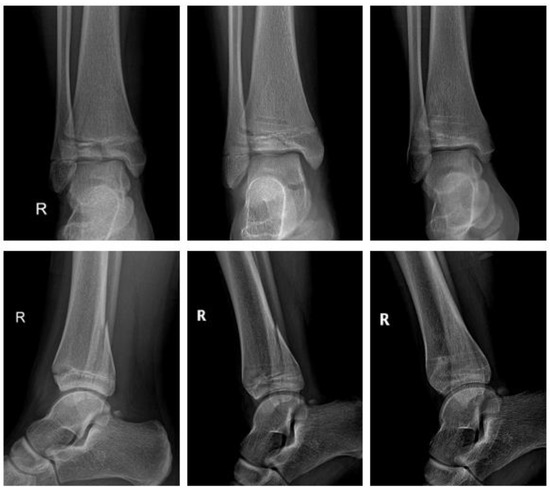 Children | An Open Access Journal from MDPI