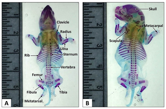 Multiple Skeletal Anomalies of Sprague Dawley Rats following Prenatal ...