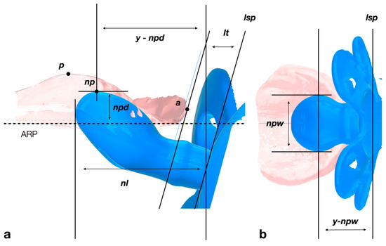 Conformity between Pacifier Design and Palate Shape in Preterm and Term ...