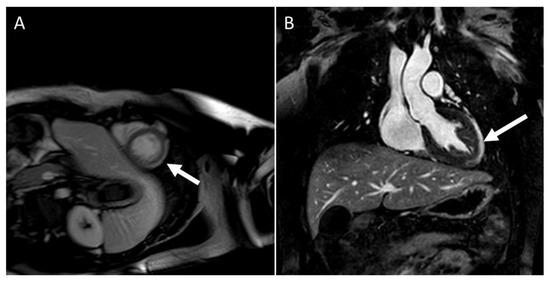 Children | An Open Access Journal from MDPI