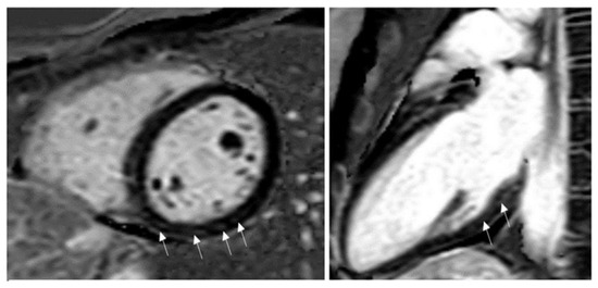 Children | An Open Access Journal from MDPI