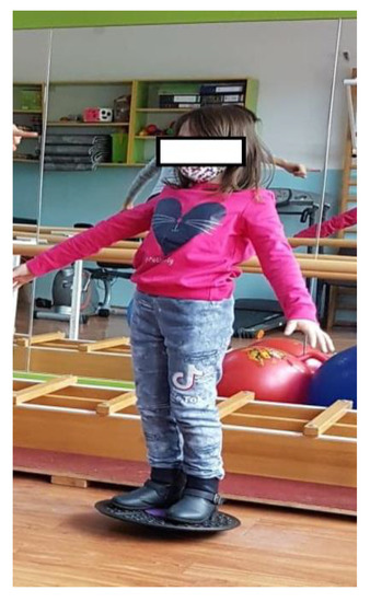 Physical Activity Design for Balance Rehabilitation in Children with ...