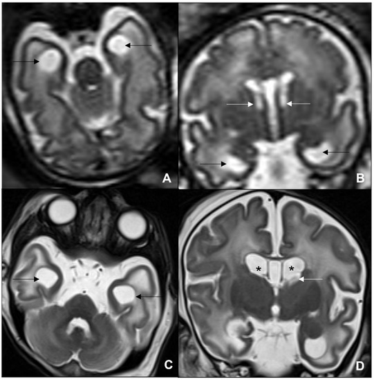 Children | An Open Access Journal from MDPI