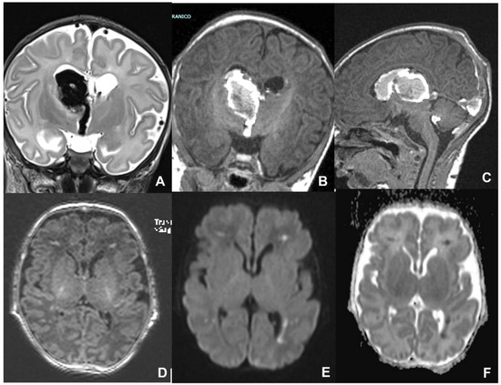 Children | An Open Access Journal from MDPI