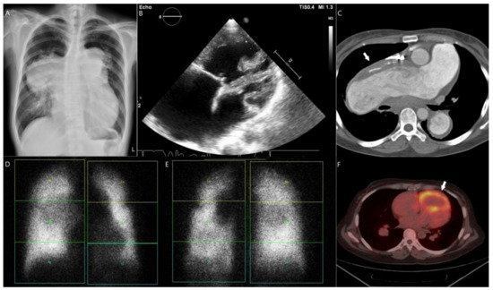 Children | An Open Access Journal from MDPI