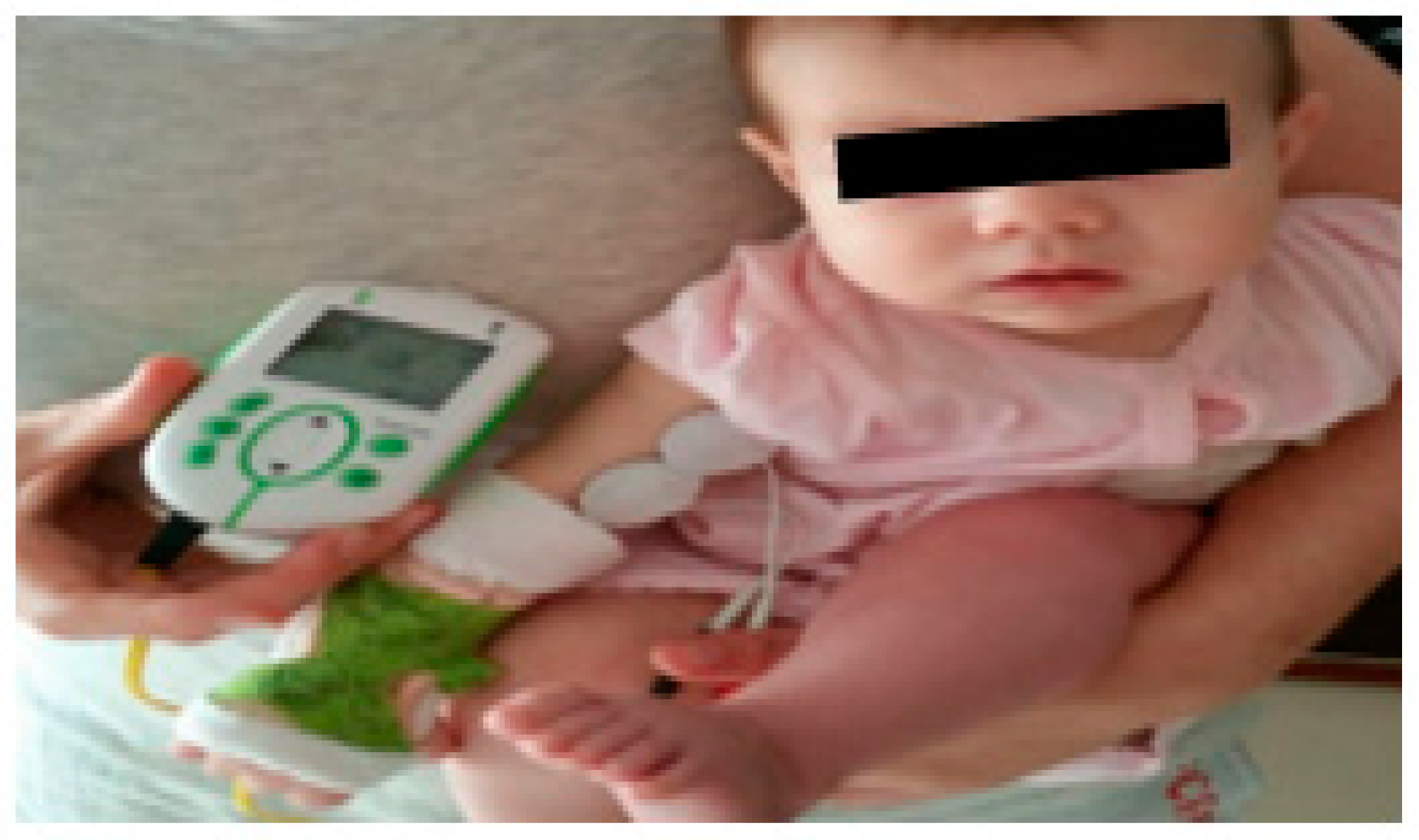 Rehabilitation of a Child with Neonatal Brachial Plexus Palsy: Case ...