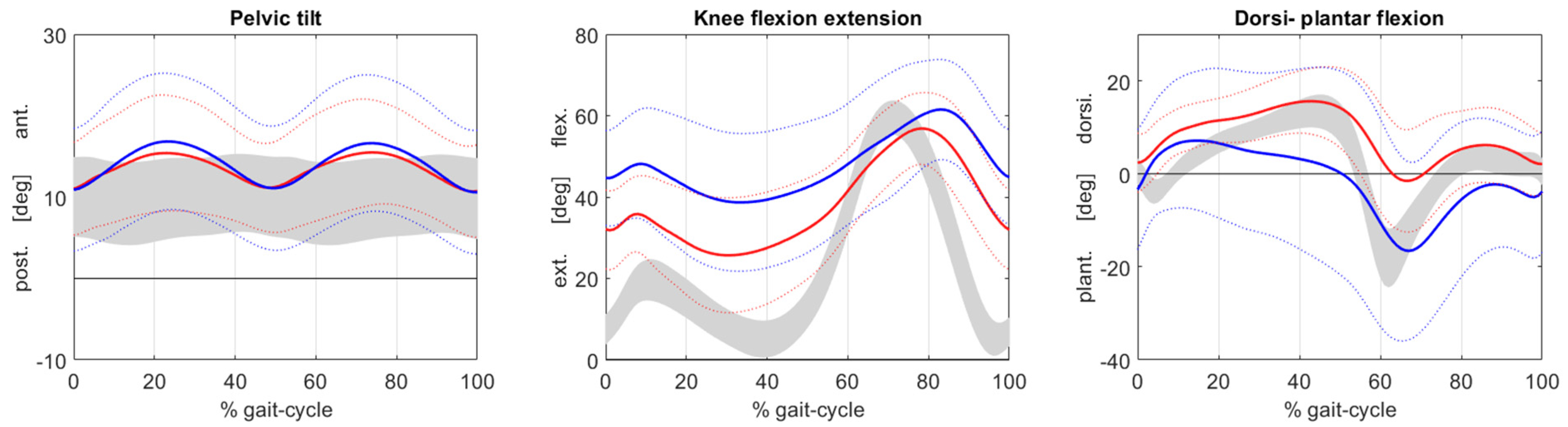 Mid-Term Results of Distal Femoral Extension and Shortening Osteotomy ...