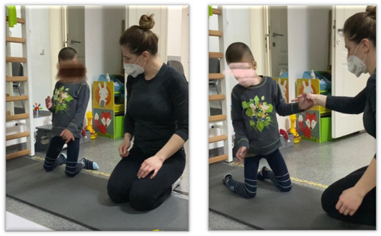 Balance Rehabilitation Approach by Bobath and Vojta Methods in Cerebral ...