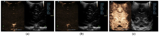 Contrast-Enhanced Ultrasound (CEUS) as an Ancillary Imaging Test for ...