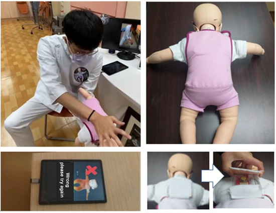 Development and Application of AR-Based Assessment System for Infant ...