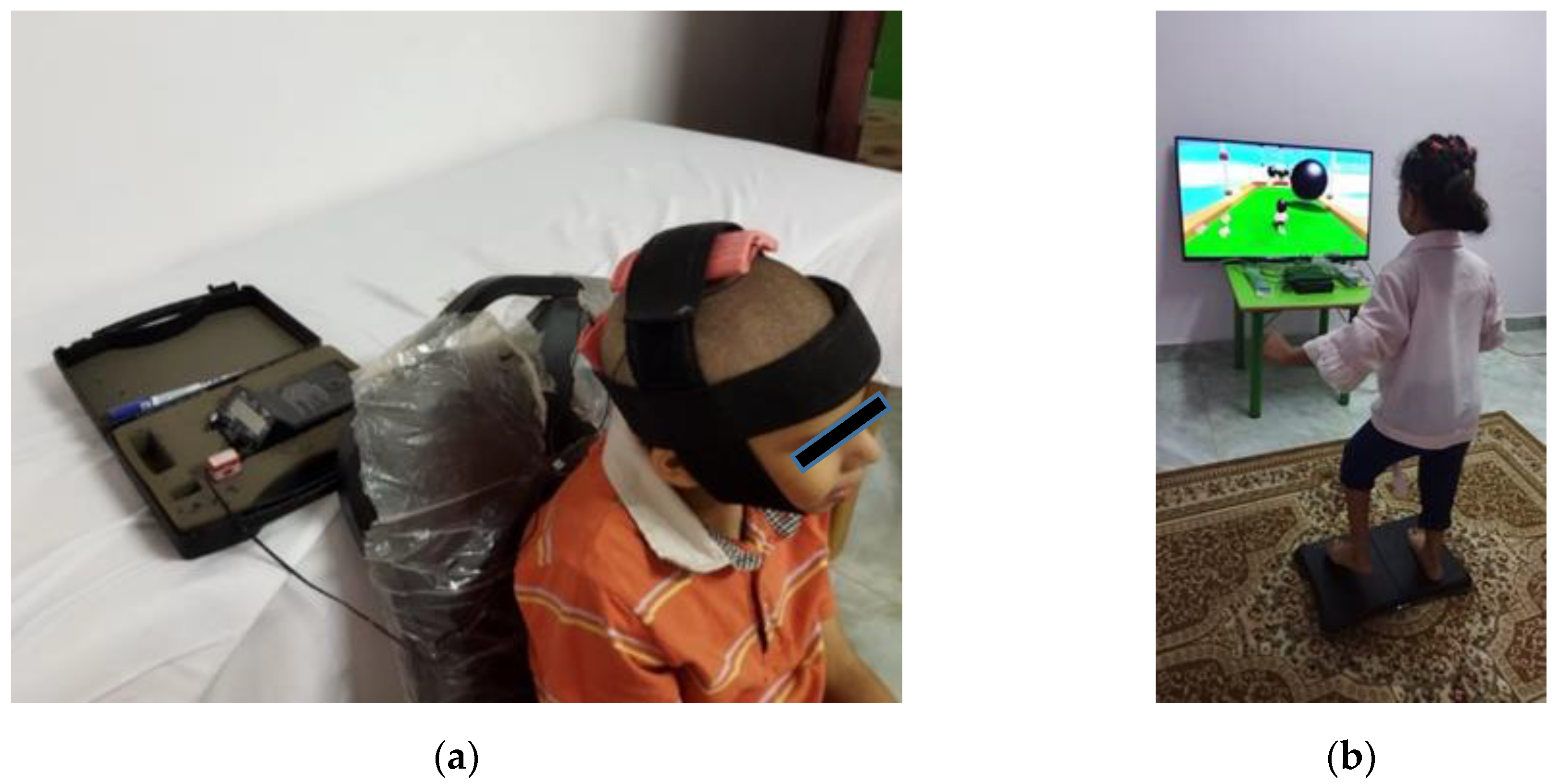 Effect of Transcranial Direct Current Stimulation versus Virtual ...