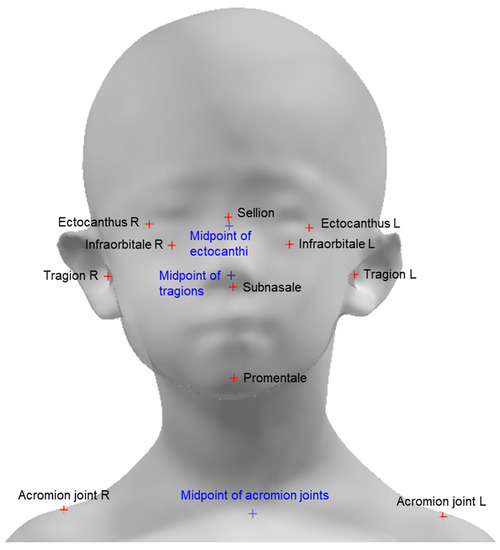 Quantitative Analysis of the Head Tilt Using Three-Dimensional Temporal ...