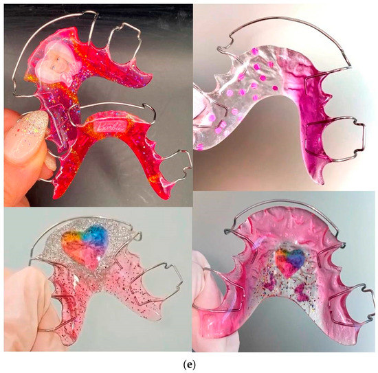 Orthodontic Retainers—A Critical Review