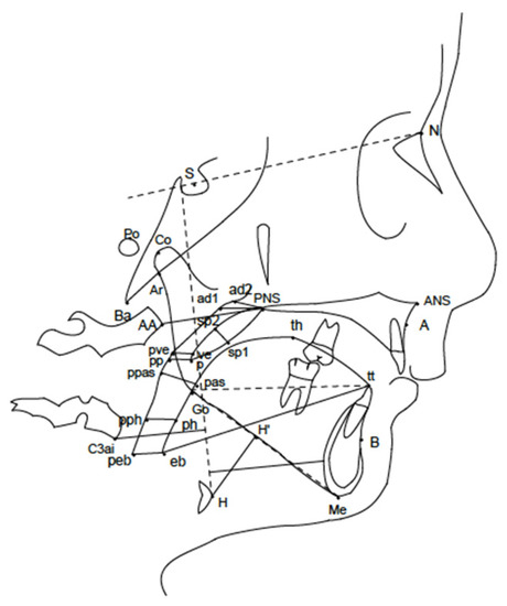 Children | Free Full-Text | Effects of Rapid Palatal Expansion on the ...