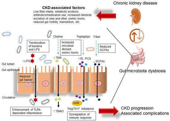Role of the Gut Microbiota in Children with Kidney Disease