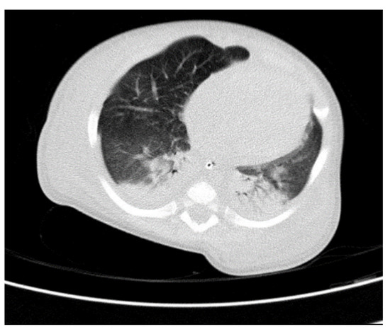 Tapvr Snowman Sign In