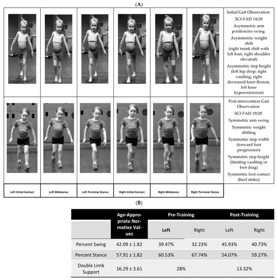 Activity-Based Restorative Therapy Promotes Progression from Asymmetry ...