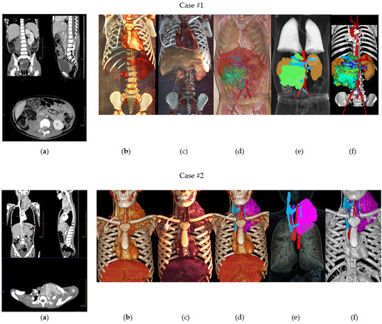 Exploring the Potential of Three-Dimensional Imaging, Printing, and ...