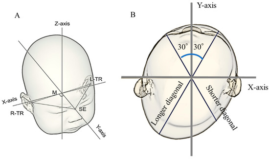 Changes in Cranial Shape and Developmental Quotient at 6 Months of Age ...