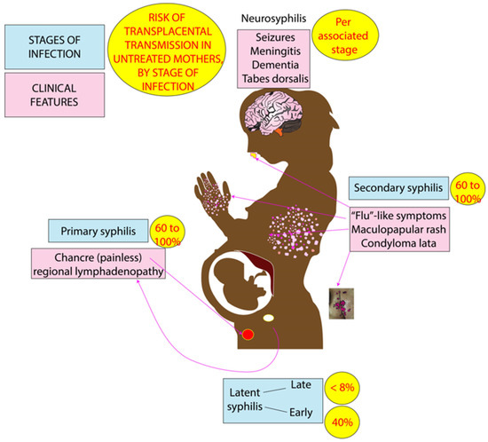 Congenital Syphilis—An Illustrative Review