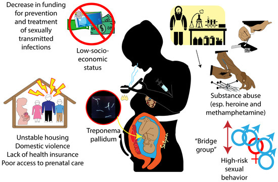 Congenital Syphilis—An Illustrative Review