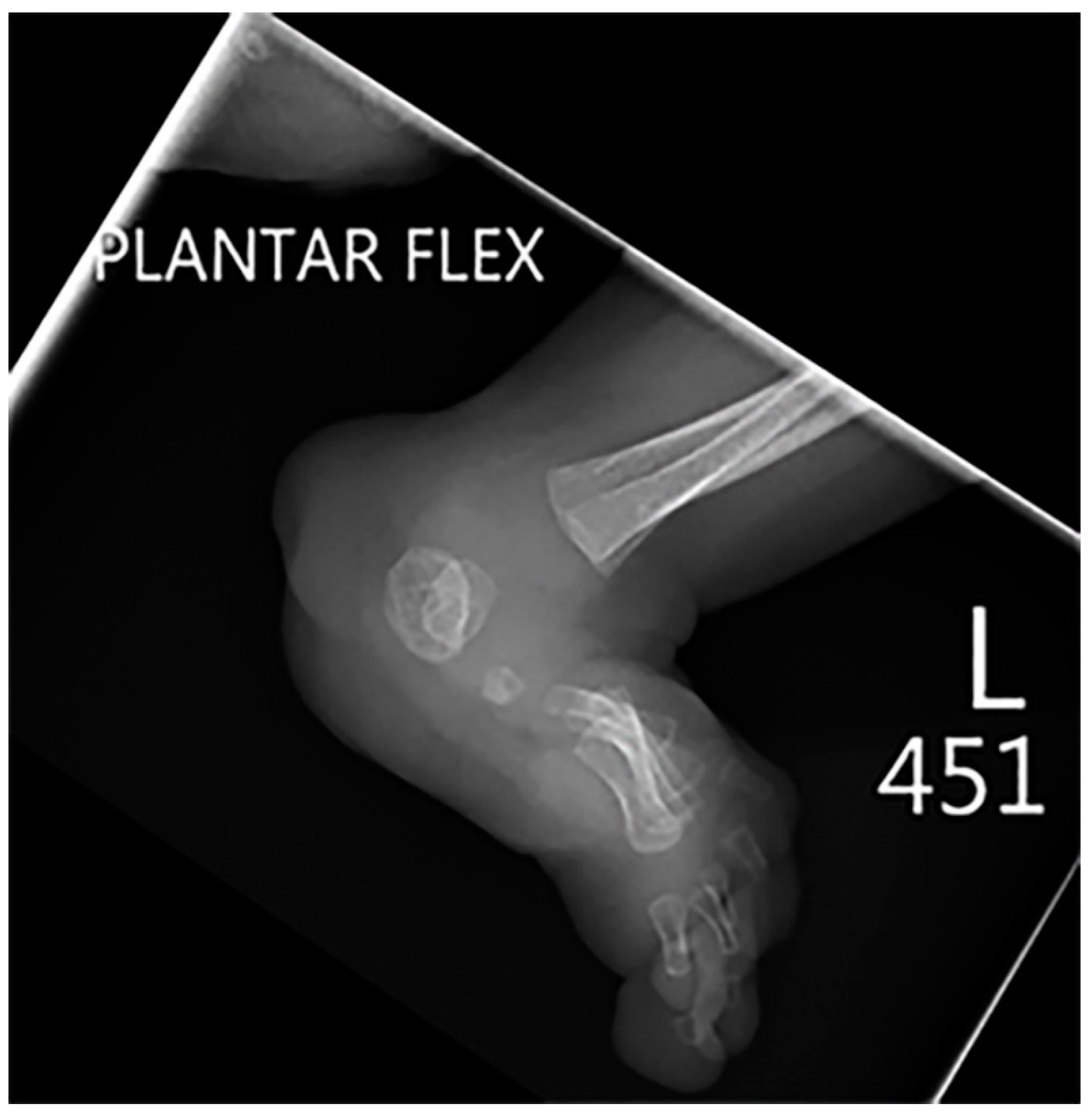 World-Renowned “Swiss” Pediatricians, Their Syndromes, and Matching ...