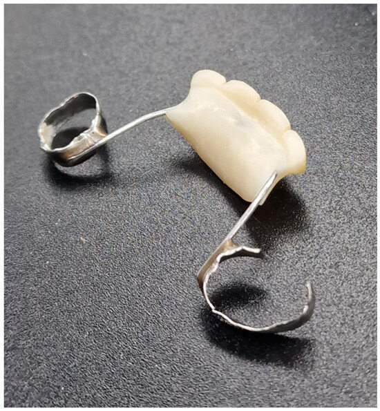 Children | Free Full-Text | Longevity of Aesthetic Fixed Space ...