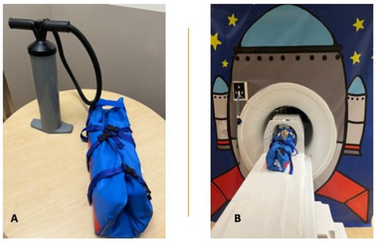 Practical Stepwise Approach to Performing Neonatal Brain MR Imaging in ...