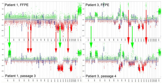 DNA Methylation Profiles Are Stable in H3 K27M-Mutant Diffuse Midline ...