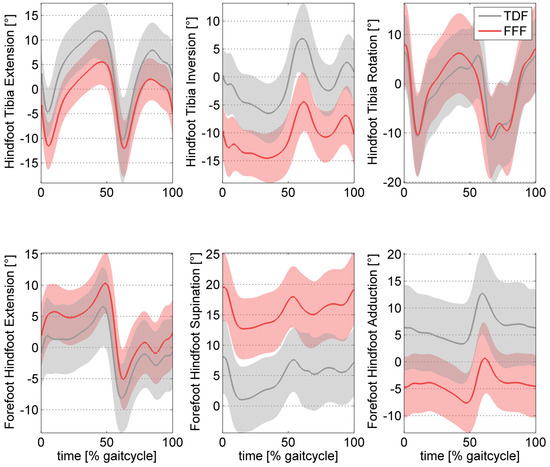 Dynamic Gait Analysis in Paediatric Flatfeet: Unveiling Biomechanical ...