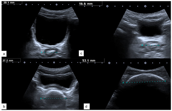 Is the Transrectal Diameter (TRD) Suitable for Assessing Faecal Loads ...