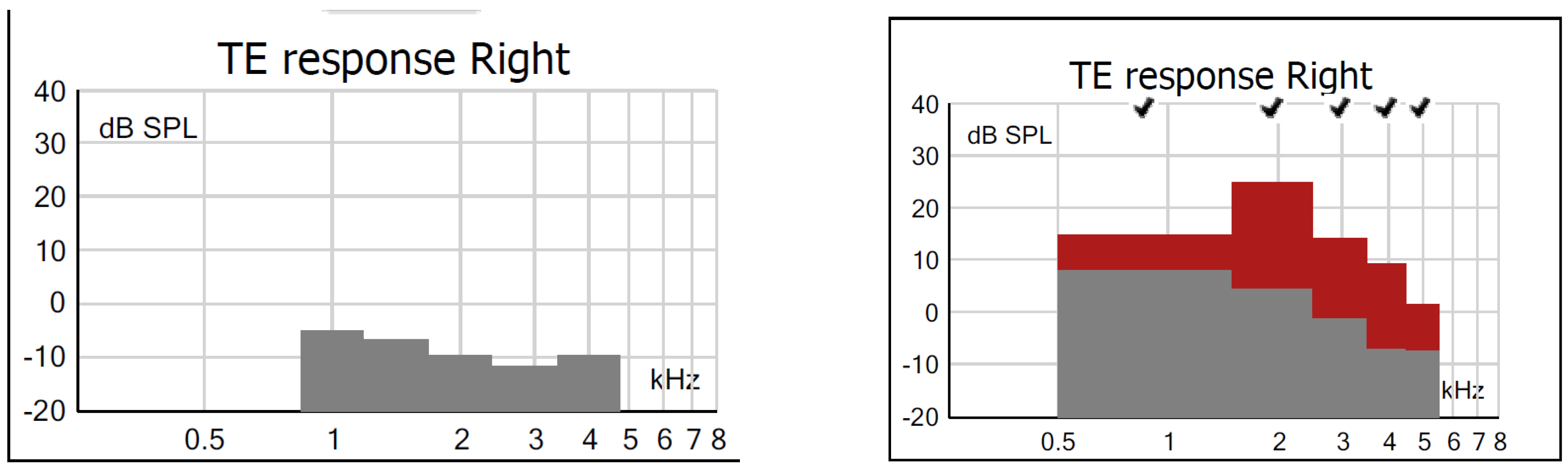 Neonatal Hearing Screening Using Wideband Absorbance and Otoacoustic ...