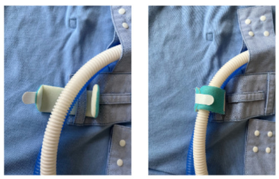 Reimagining Kangaroo Care for Preterm Infants: A Novel Garment for Safe ...