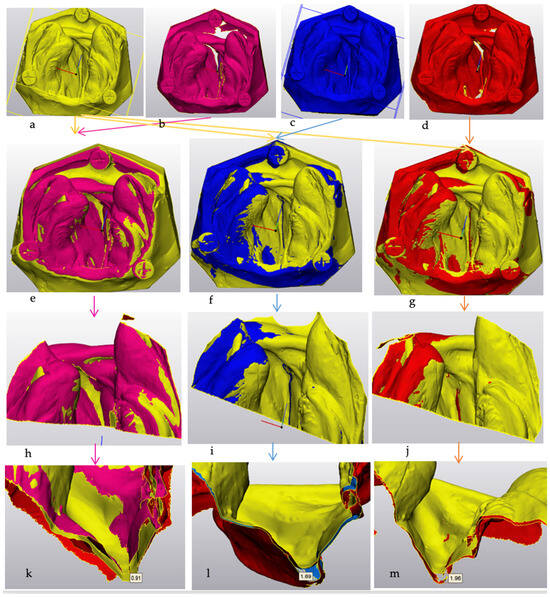 Enhancing Effective Scanning Techniques for Digital Impression in ...