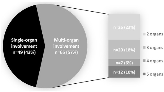 The Management of IgG4-Related Disease in Children: A Systematic Review