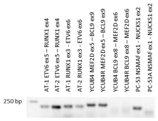CIMB | Free Full-Text | Molecular Genetics of Pre-B Acute Lymphoblastic ...